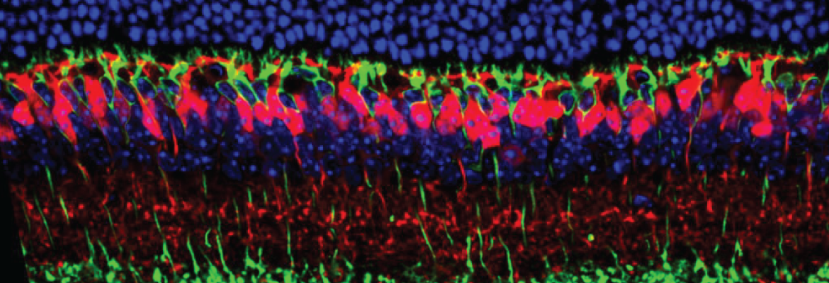Our Research | Zipursky Lab
